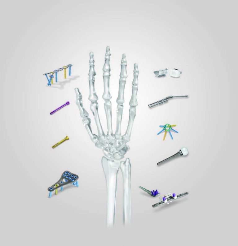 KLS Martin - Aleamed